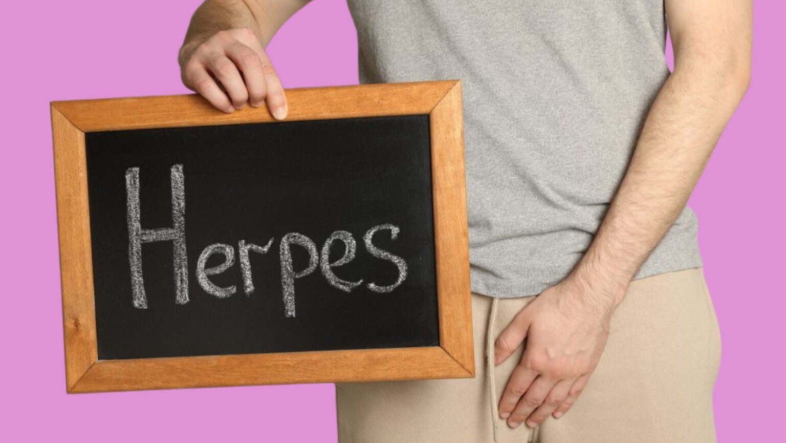Genital Herpes: A Guide to Symptoms and Treatments