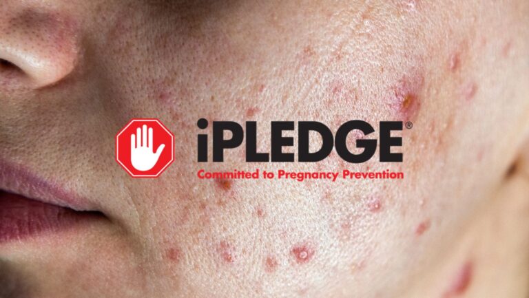 Understanding iPledge When Starting Accutane | DermOnDemand