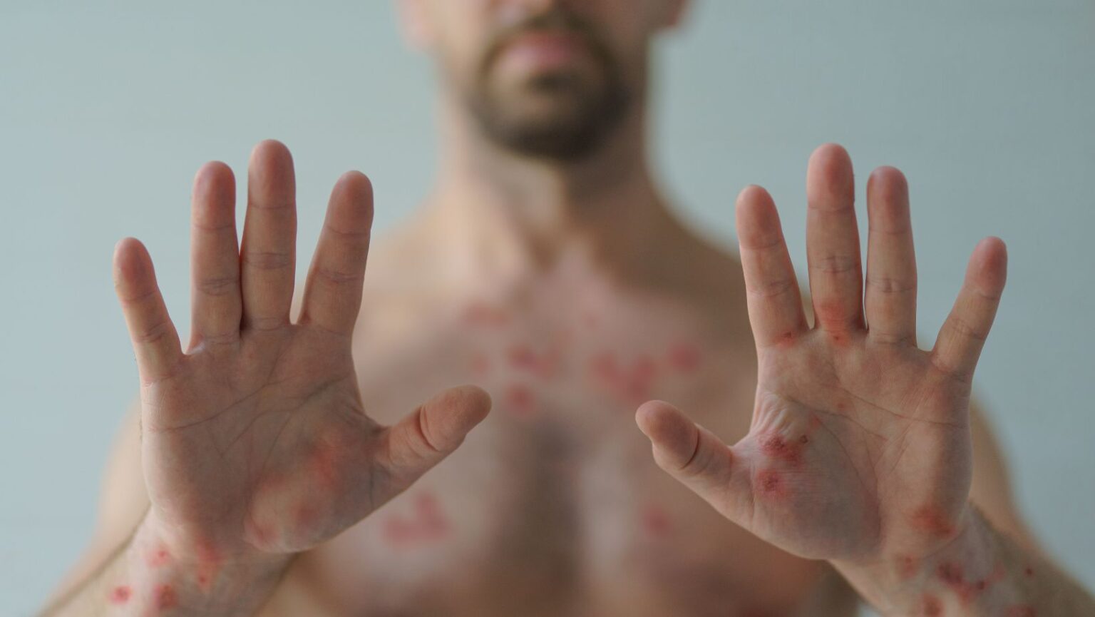 8 Common Causes for Red Skin Spots