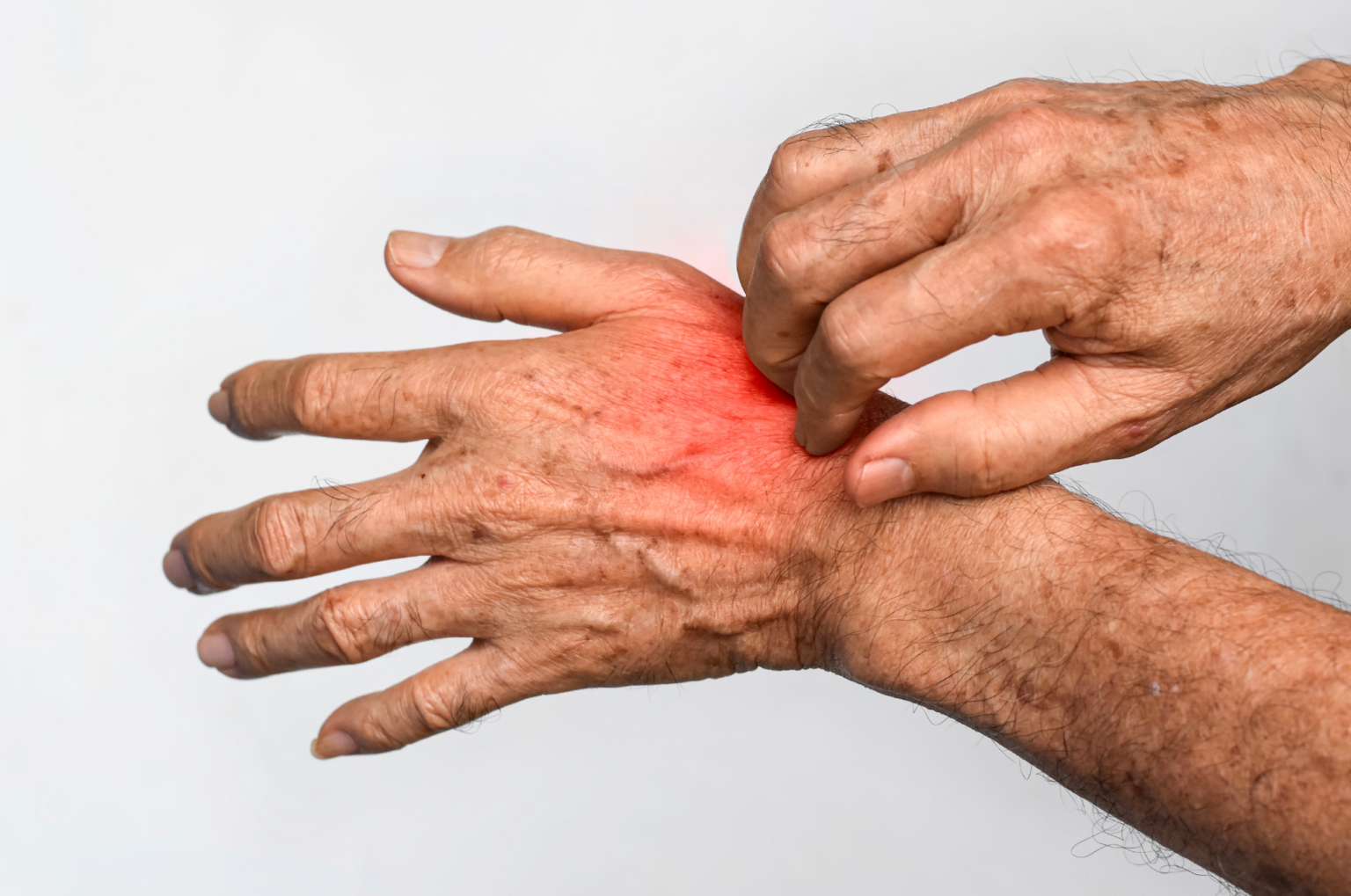 Burning Skin Sensation: Causes, Symptoms, and Treatment - DermOnDemand